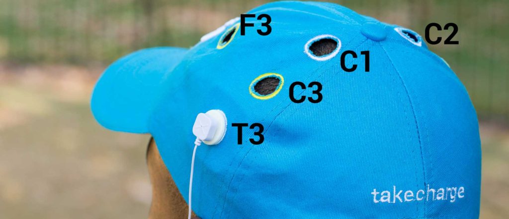 Focus | DIY tDCS